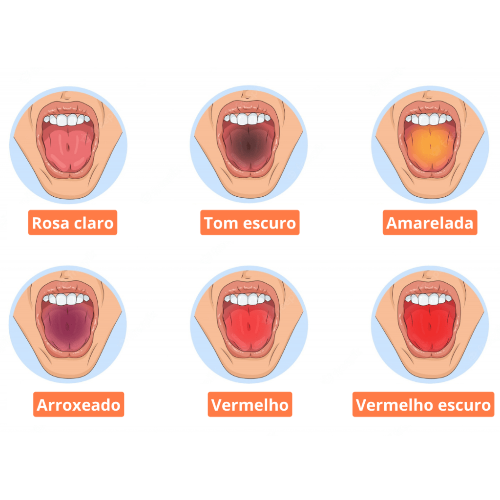 O que a cor da língua indica? - Prime Sorriso Foz do Iguaçu