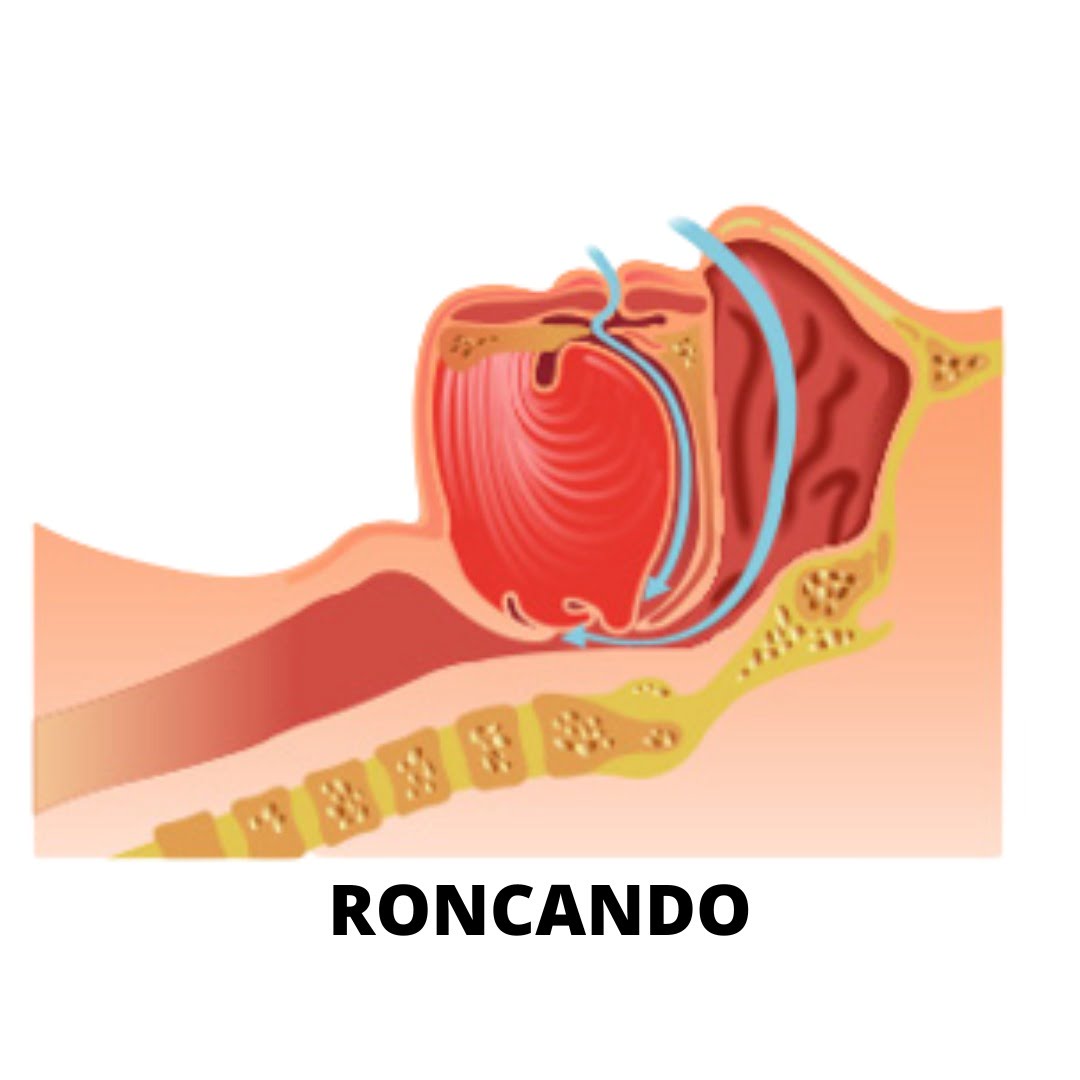 LP-Parar-roncar-imagens (2) - Dentista em Foz do Iguaçu - Aparelho ...